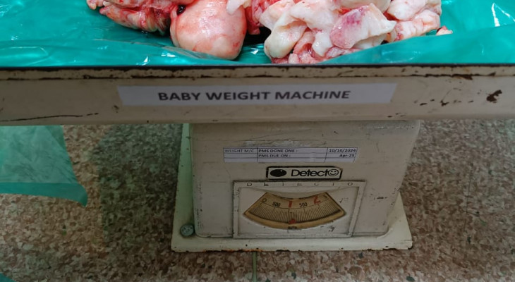 Mumbai Team Removes 1.25‑kg Fibroid Uterus Via Keyhole Surgery - BW ...