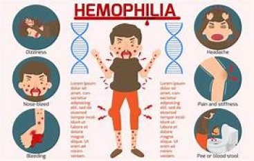 Understanding Haemophilia: Causes, Treatments, Recommendations - BW Healthcare World