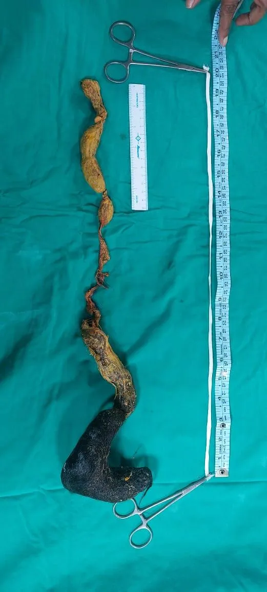 Getinge Unveils Maquet Corin Operating Table & Maquet Ezea Surgical ...