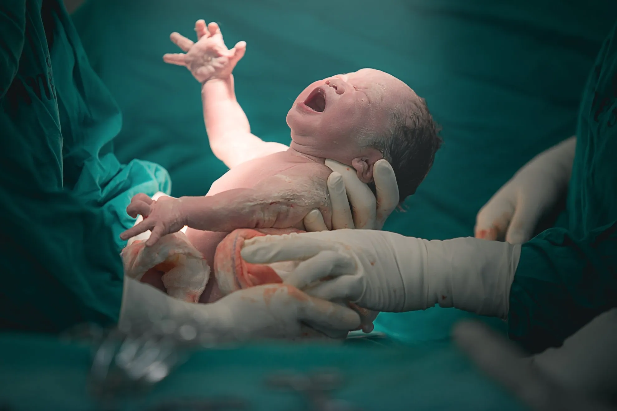 A Breath Of Hope: Navigating Congenital Diaphragmatic Hernia (CDH) – A ...
