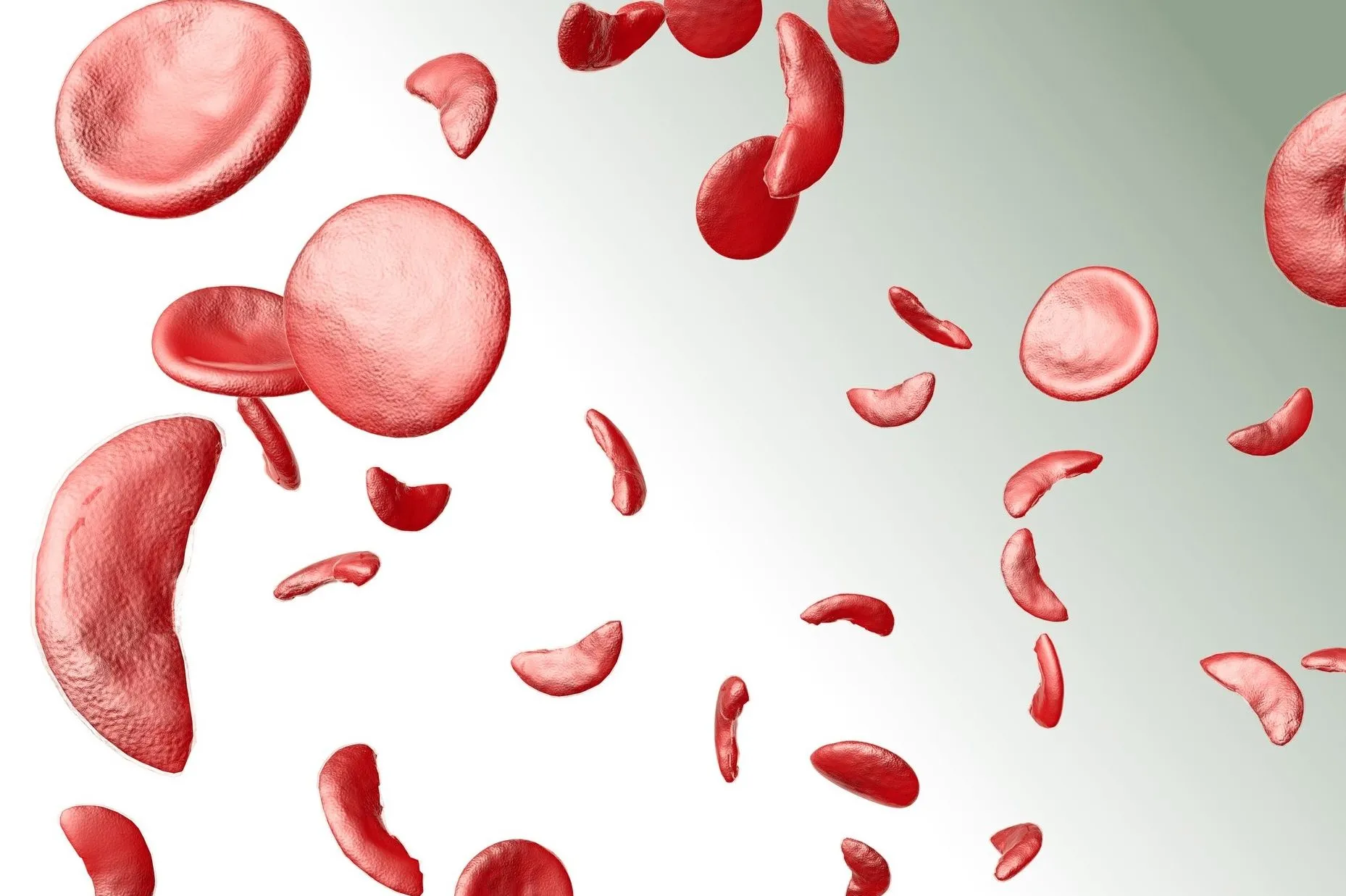 Pain Management Protocols: Approaches To Sickle Cell Disease - BW ...