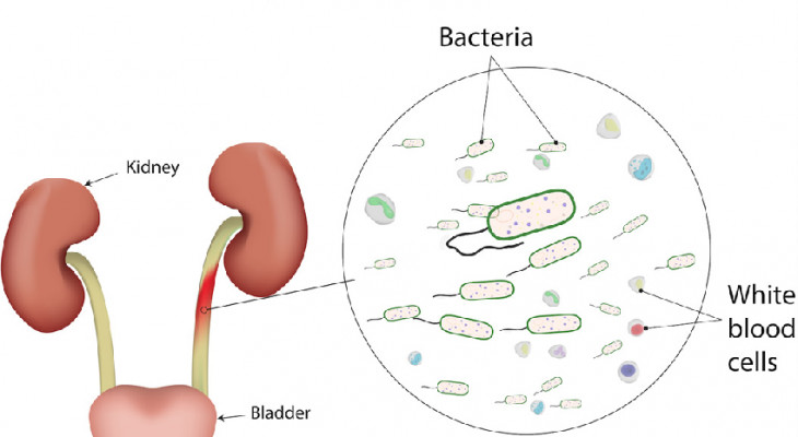 Unveiling The Gut-Bladder Connection: Pioneering Paths For Urinary ...