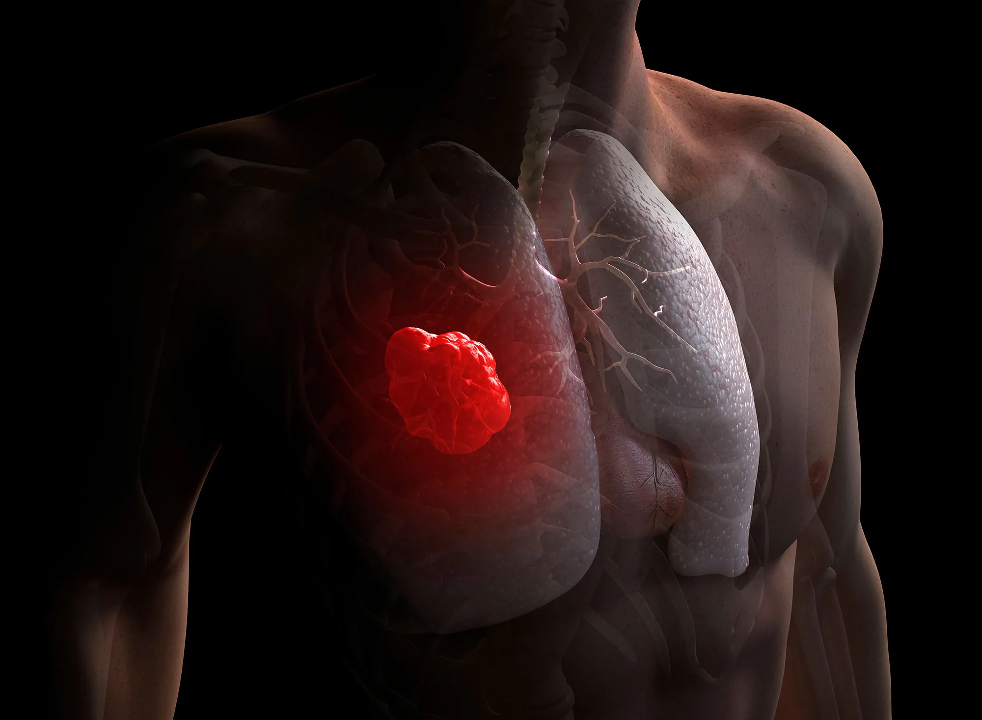 Star Health Unveils Flexible ‘Star Flexi’ Riders For Super Star Plan ...