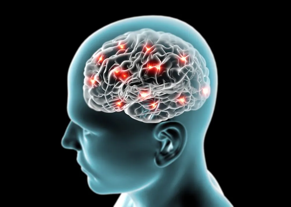 Understanding Epilepsy: Connections, Myths, & Triggers - BW Healthcare ...