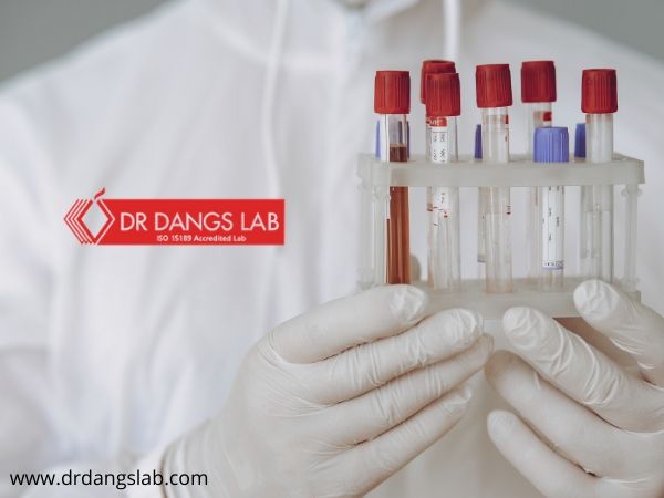In a first, Dr Dangs Lab begins bacteriophage susceptibility testing to ...
