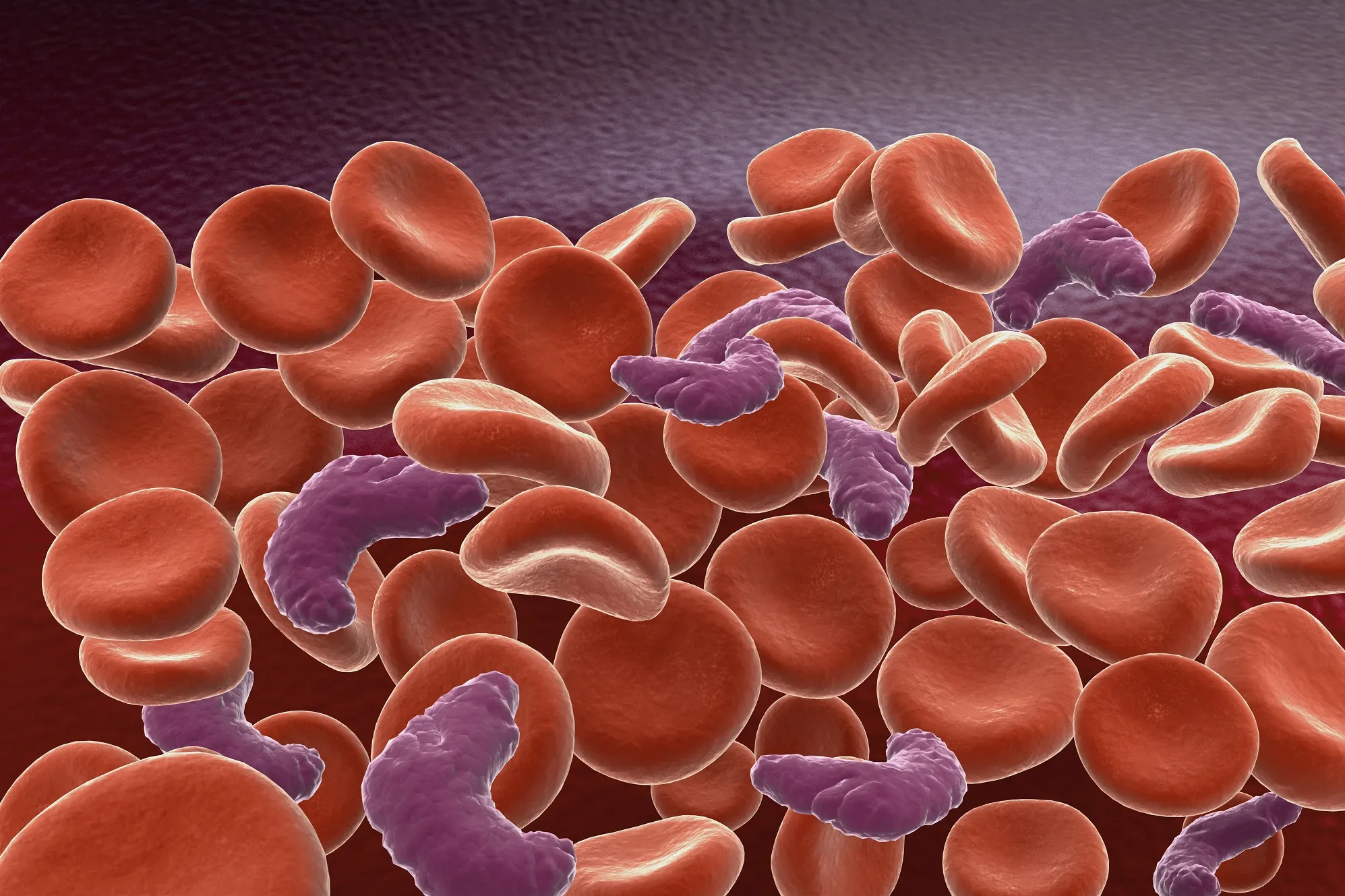 Importance Of Early Screening For Sickle Cell Anemia On Childhood ...
