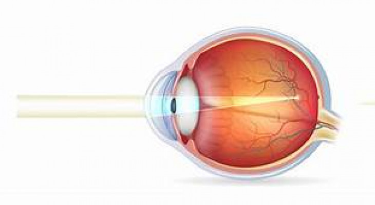 Myopia Control Options For Kids: What Every Parent Needs To Know - BW ...