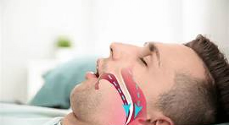 ResMed Launches AirSense 11 To Revolutionise Sleep Apnea Management In ...