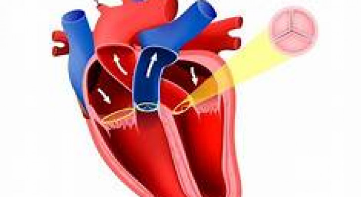 Abbott Introduces Navitor Vision For Advanced Aortic Valve Treatment In ...