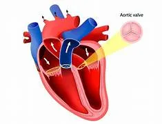 Abbott Introduces Navitor Vision For Advanced Aortic Valve Treatment In ...