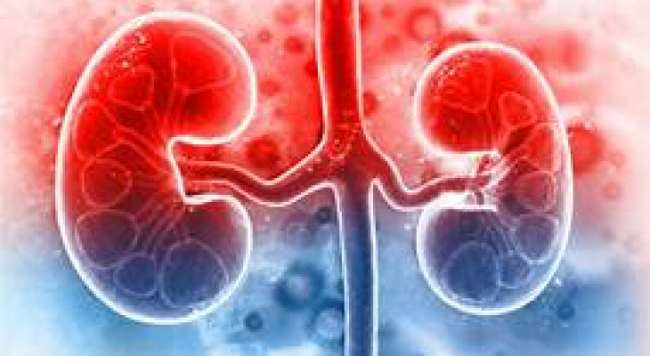 NephroPlus Launches Free Kidney Screening Camps - BW Healthcare World